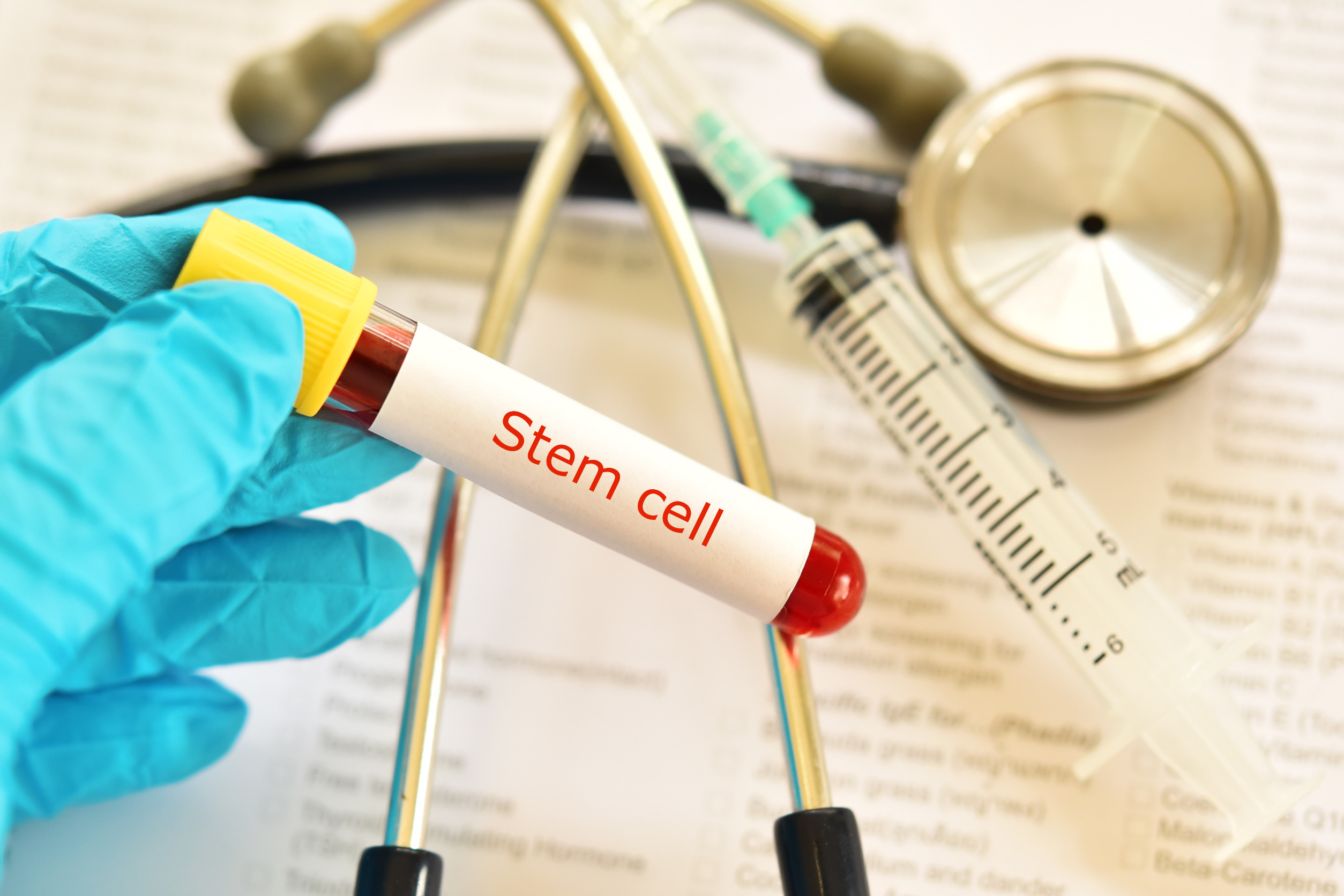Stem cells – what is the evidence? - inFOCUS